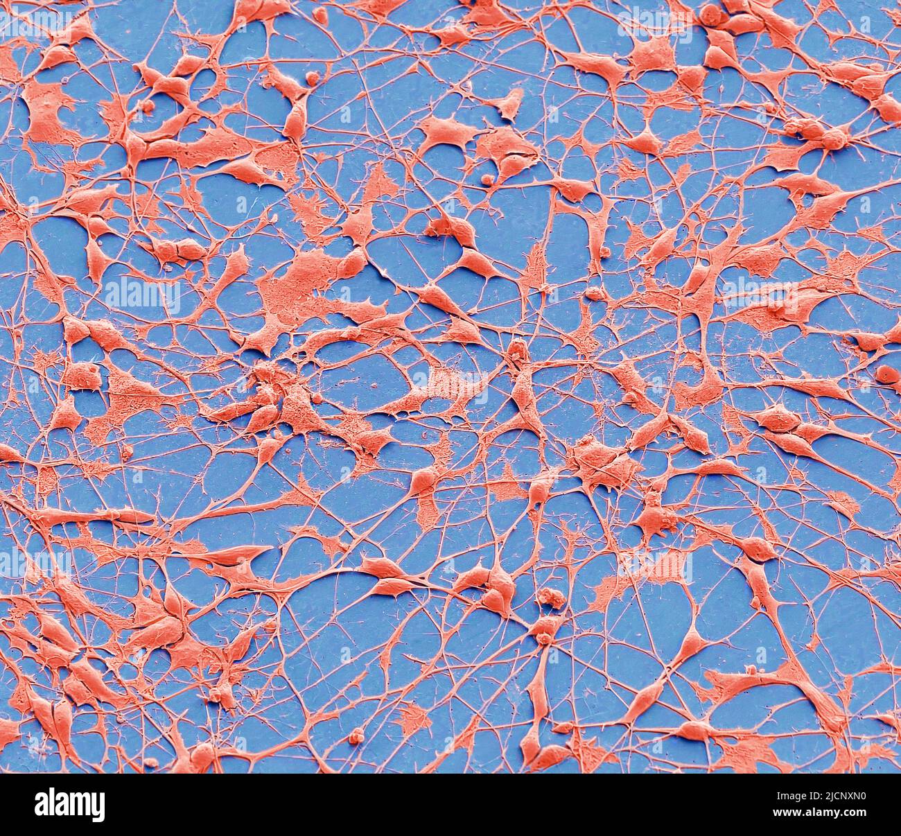 Pluripotent derived neurones. Coloured scanning electron micrograph ...