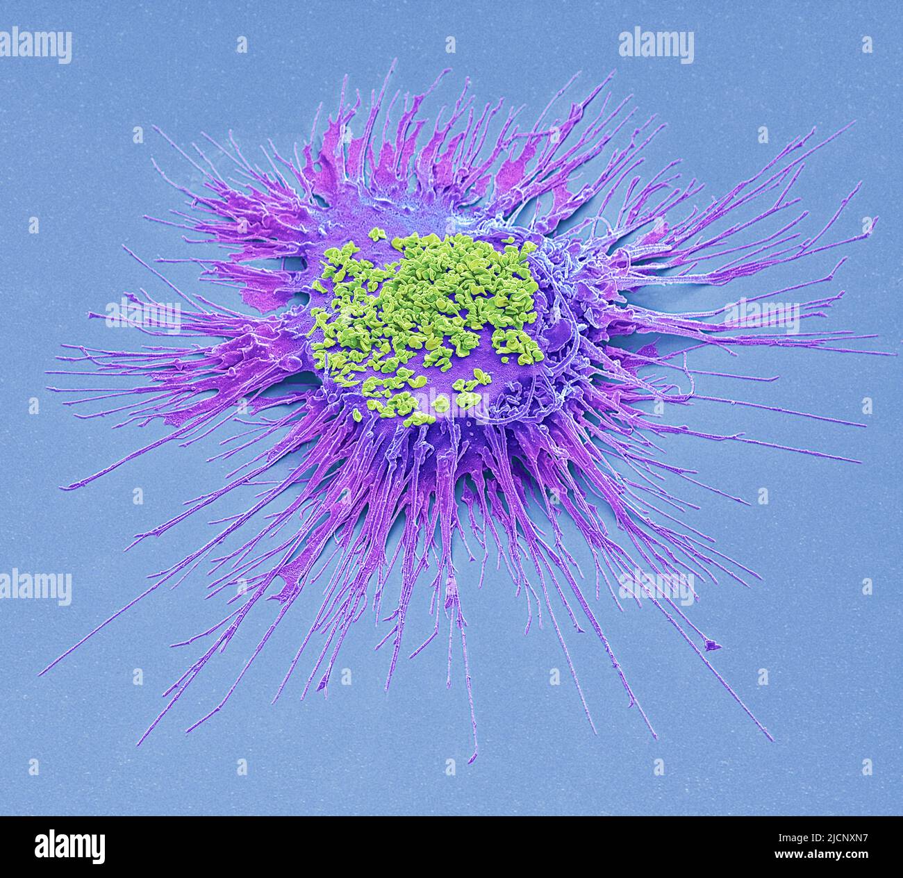 Mycoplasma. Composition coloured scanning electron micrograph (SEM) of ...