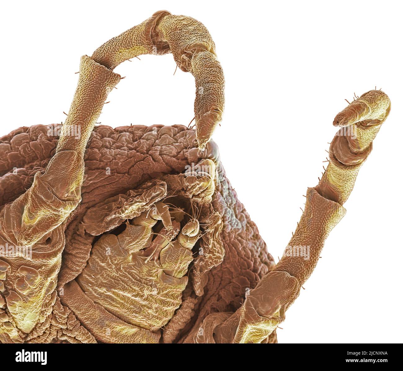 Ornithodoros tick. Coloured scanning electron micrograph (SEM) of an ...
