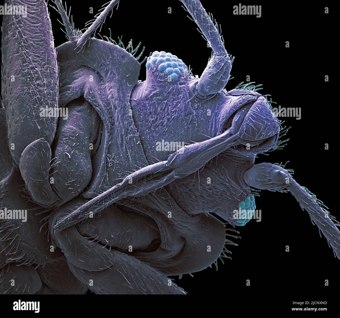 Bedbug head. Coloured scanning electron micrograph (SEM) of the head of ...