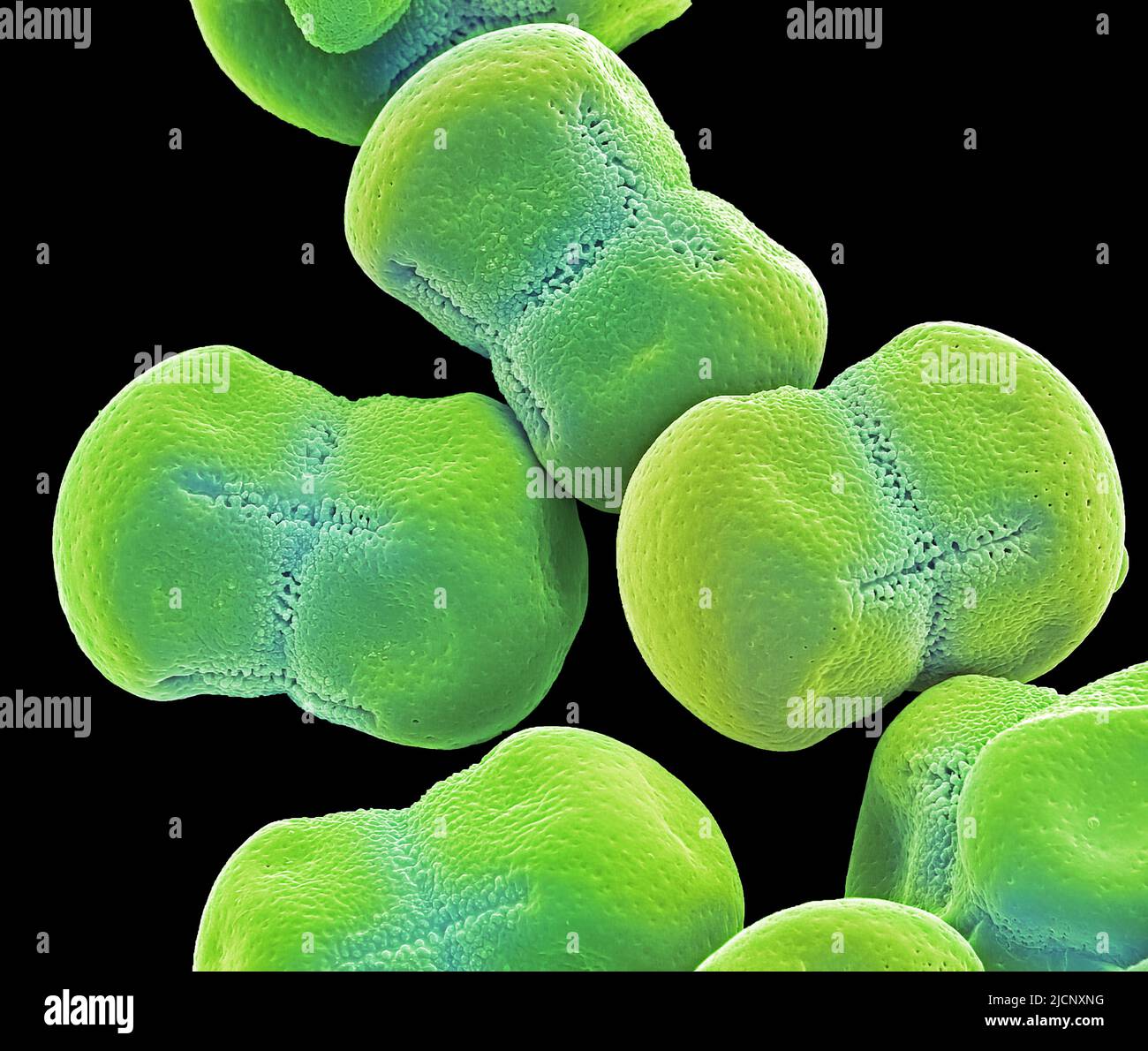 Pollen of Pulmonaria. Coloured scanning electron micrograph (SEM ...