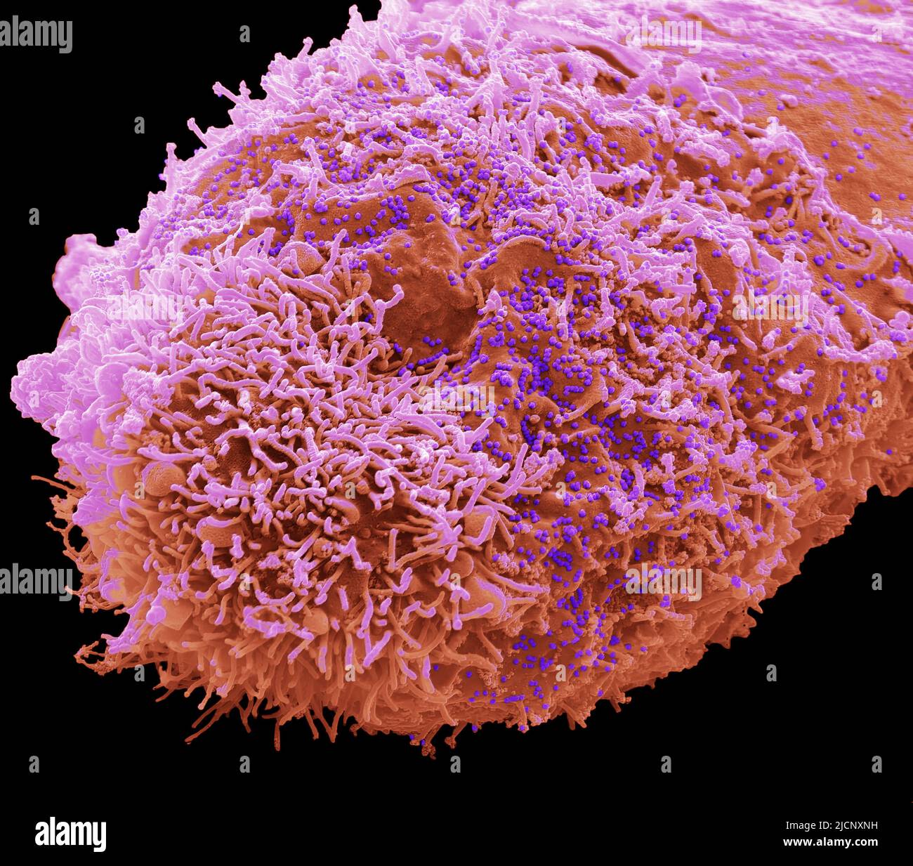 SARS-CoV-2 Omicron variant. Coloured scanning electron micrograph (SEM ...
