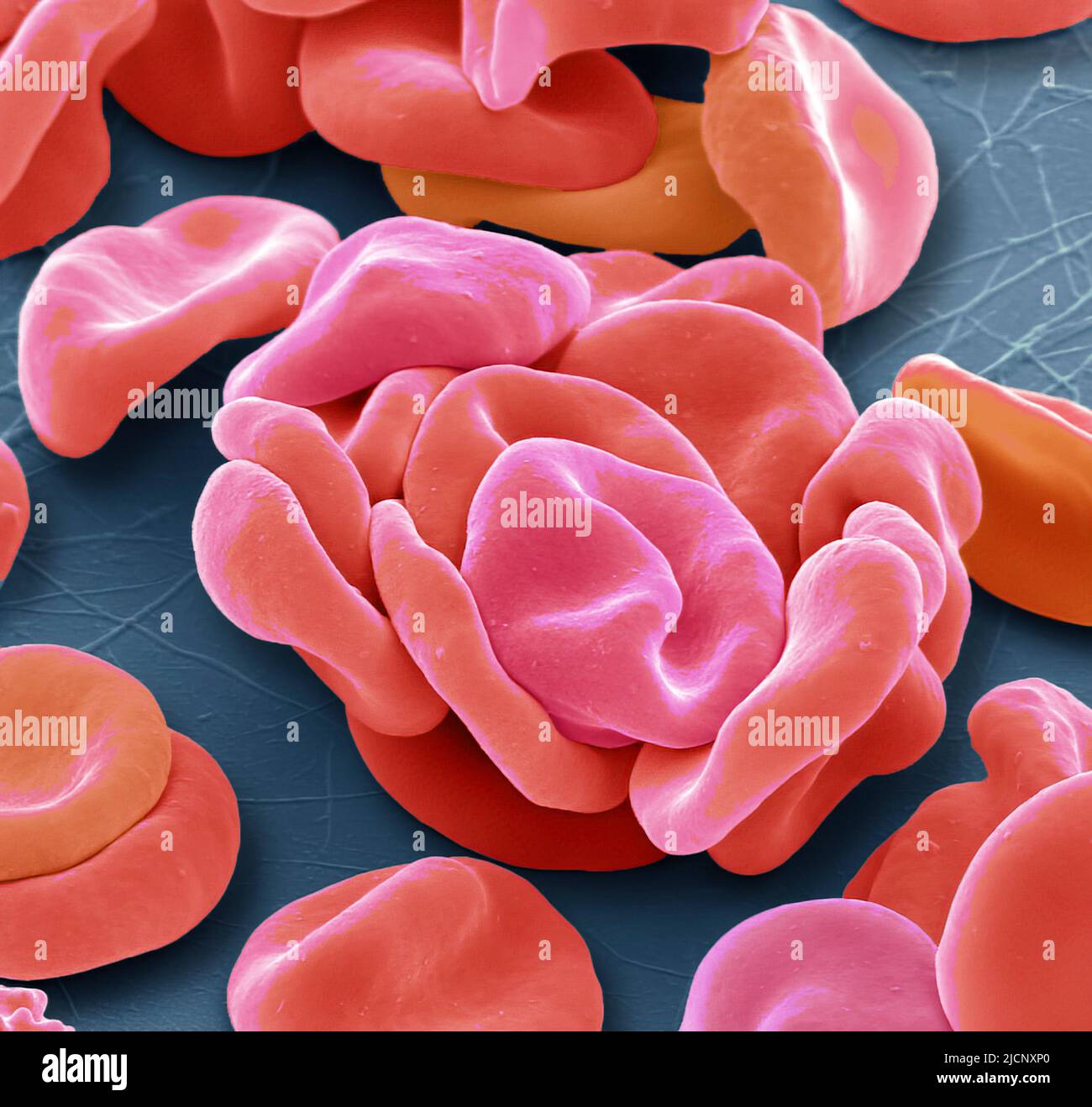 Red blood cells. Coloured scanning electron micrograph (SEM) of red ...