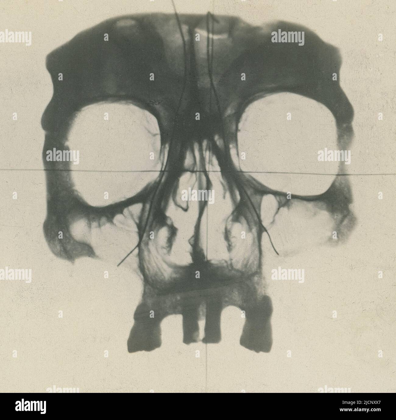 Human skull, X-ray Stock Photo - Alamy