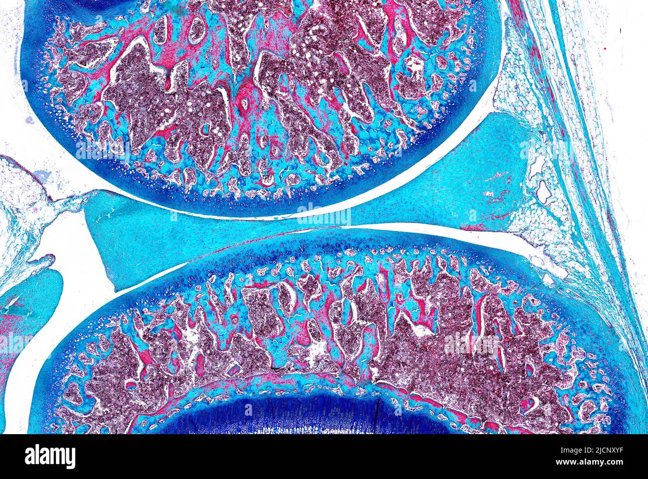Synovial joint, light micrograph. The joint space between articular ...