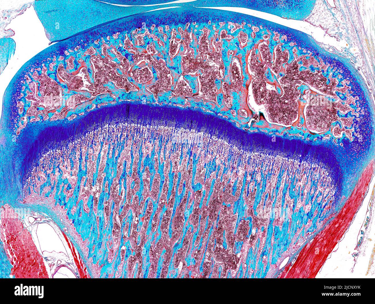 Bone tissue, light micrograph. Proximal aspect of a growing femur. The ...
