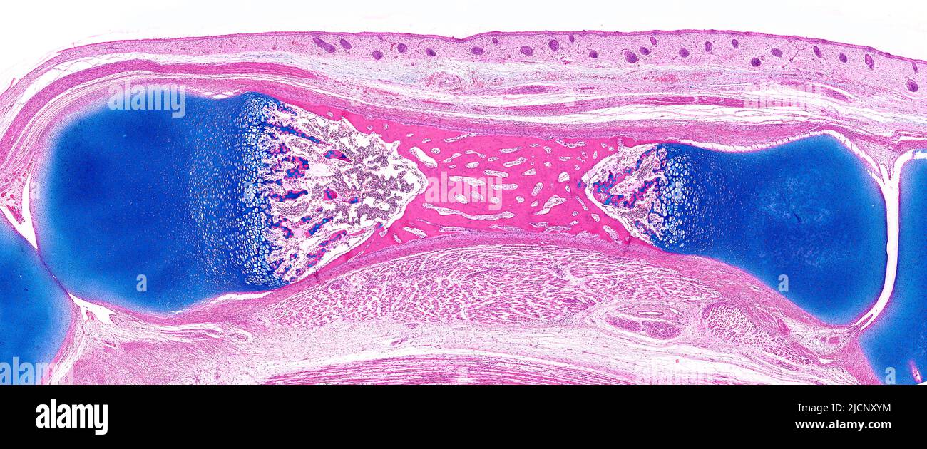 Growing bone, light micrograph. Bone development by endochondral ...