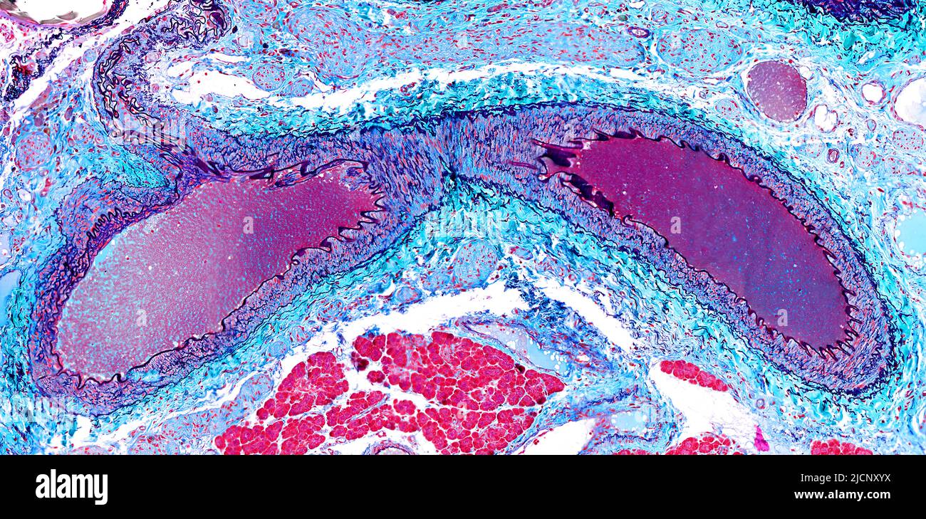 Light micrograph of a longitudinal section of an arteriole. The wall ...