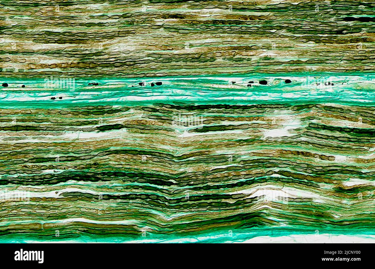 Myelinated nerve, light micrograph. Longitudinal view of a peripheral ...