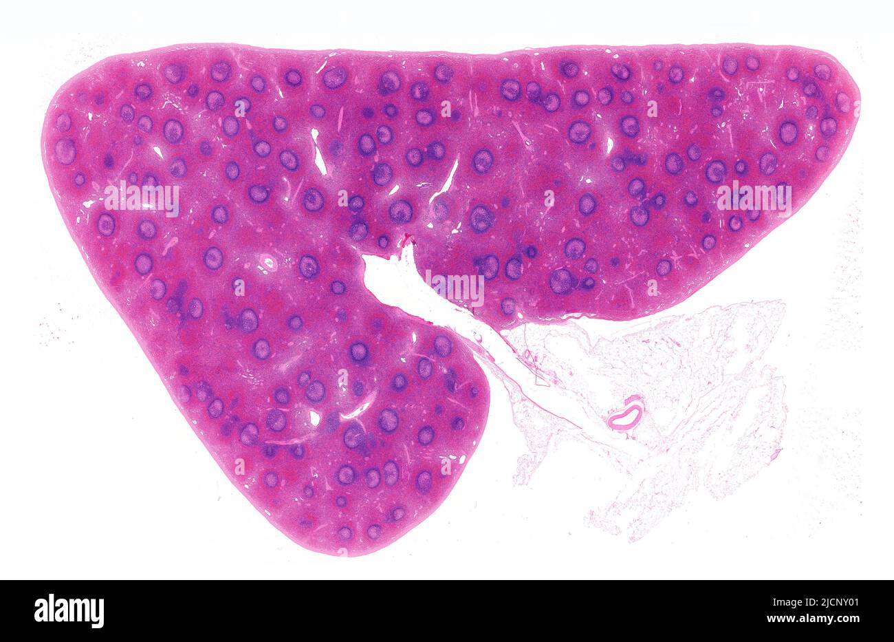Spleen, light micrograph. The spleen shows many lymphoid follicles ...