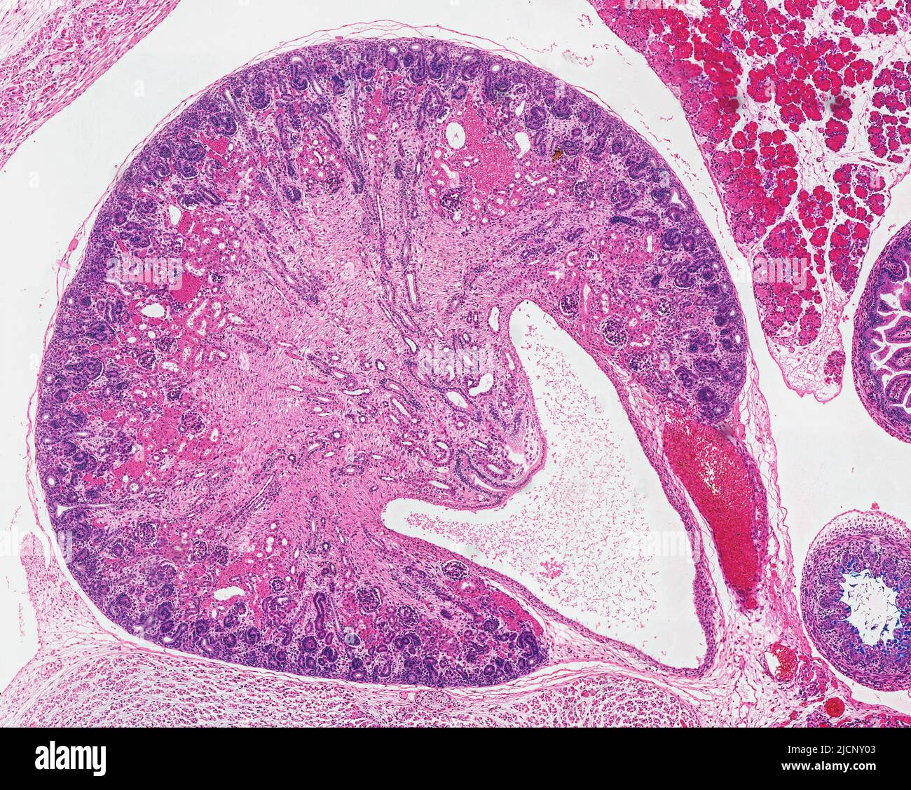 Foetal kidney, light micrograph. The developing kidney shows many ...