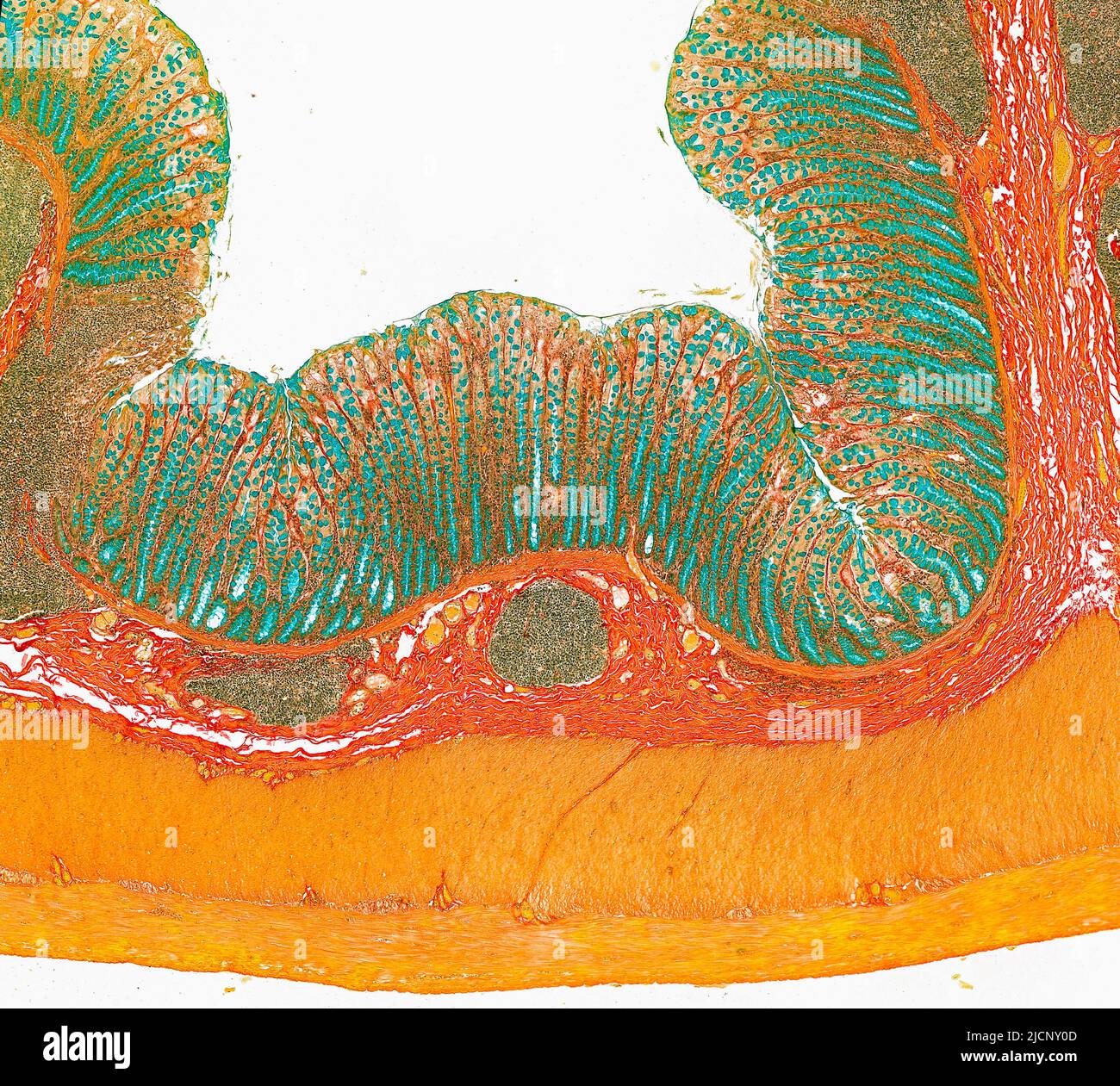 Light micrograph of the large bowel (colon) showing the mucosa (green ...