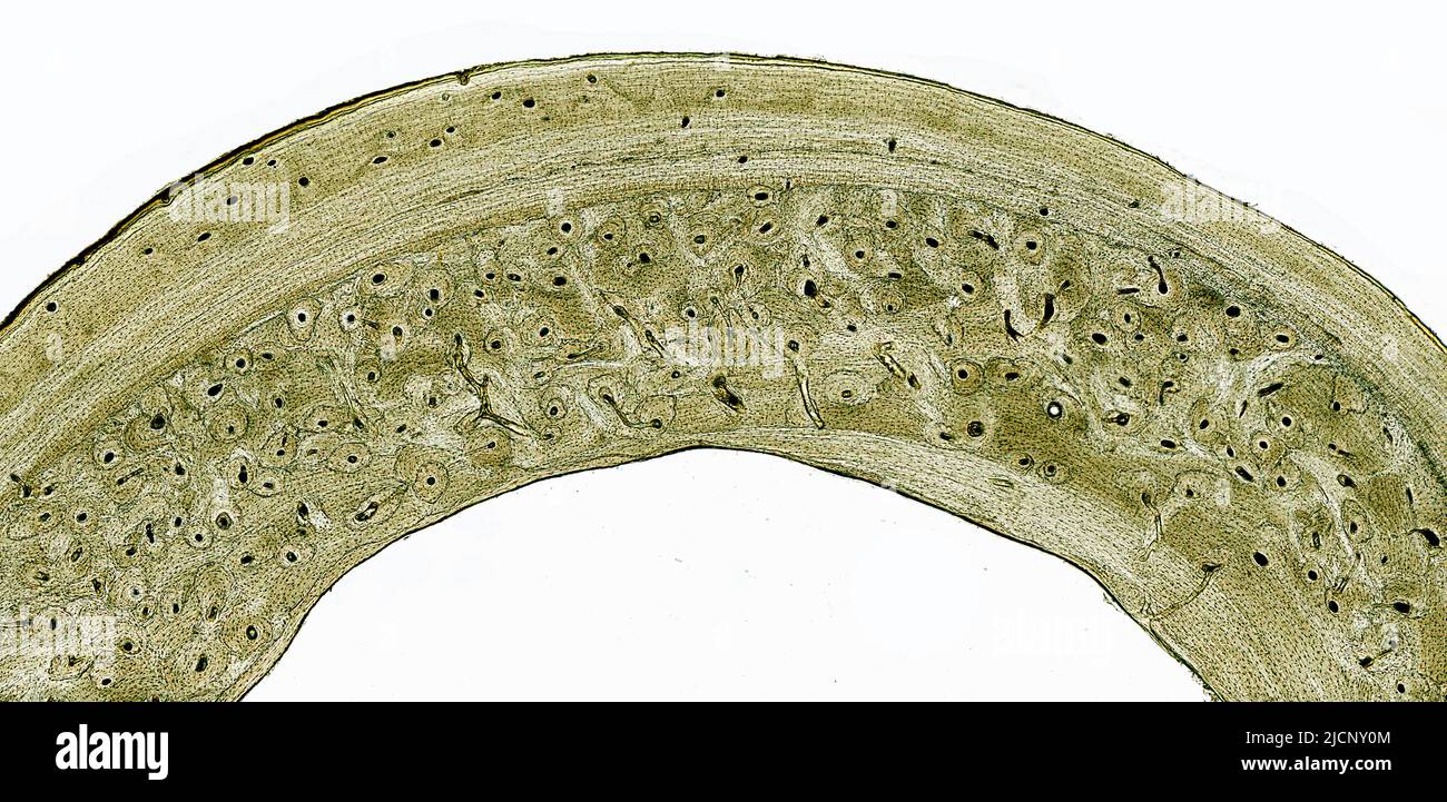 Light micrograph of a unstained ground section of an adult long bone ...