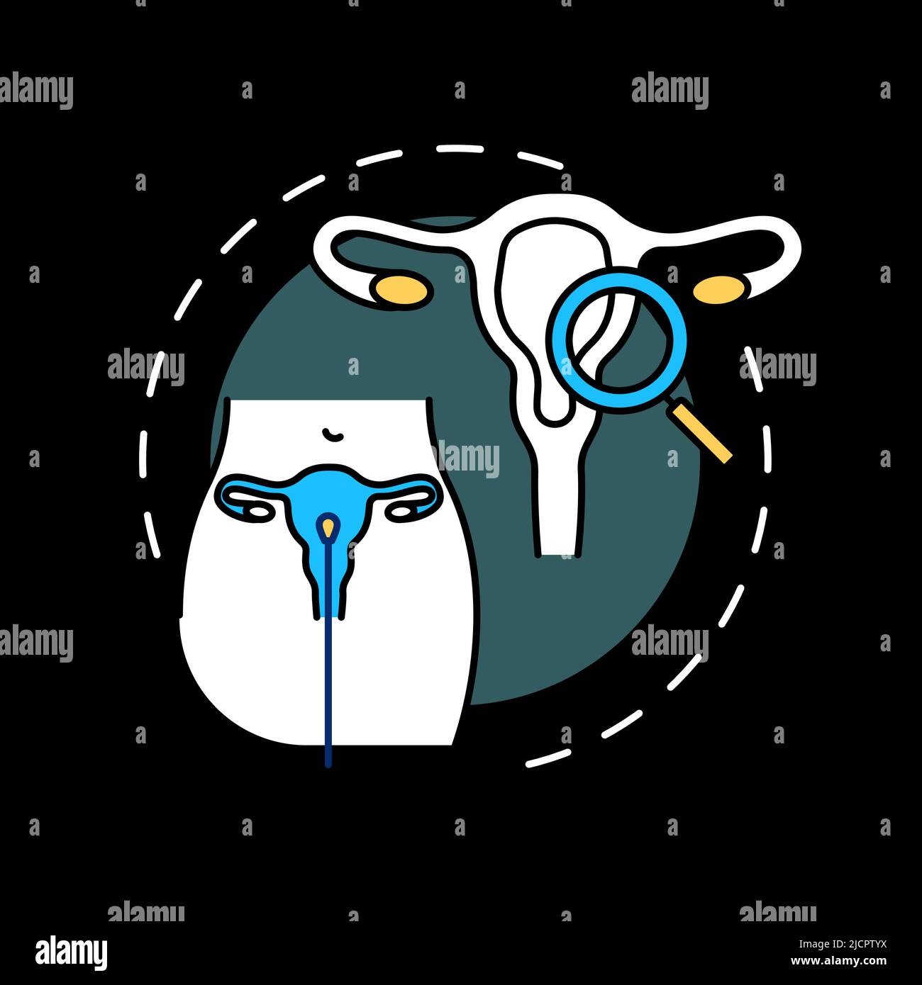 Woman gynecological exam Stock Vector Images - Alamy