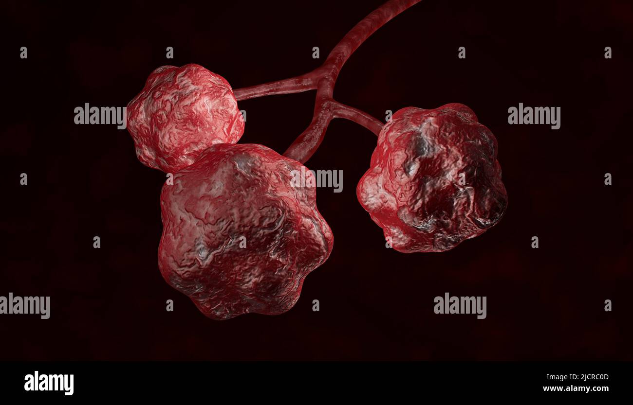 3d Rendering of Alveoli in lungs. Clipping path included Stock Photo ...