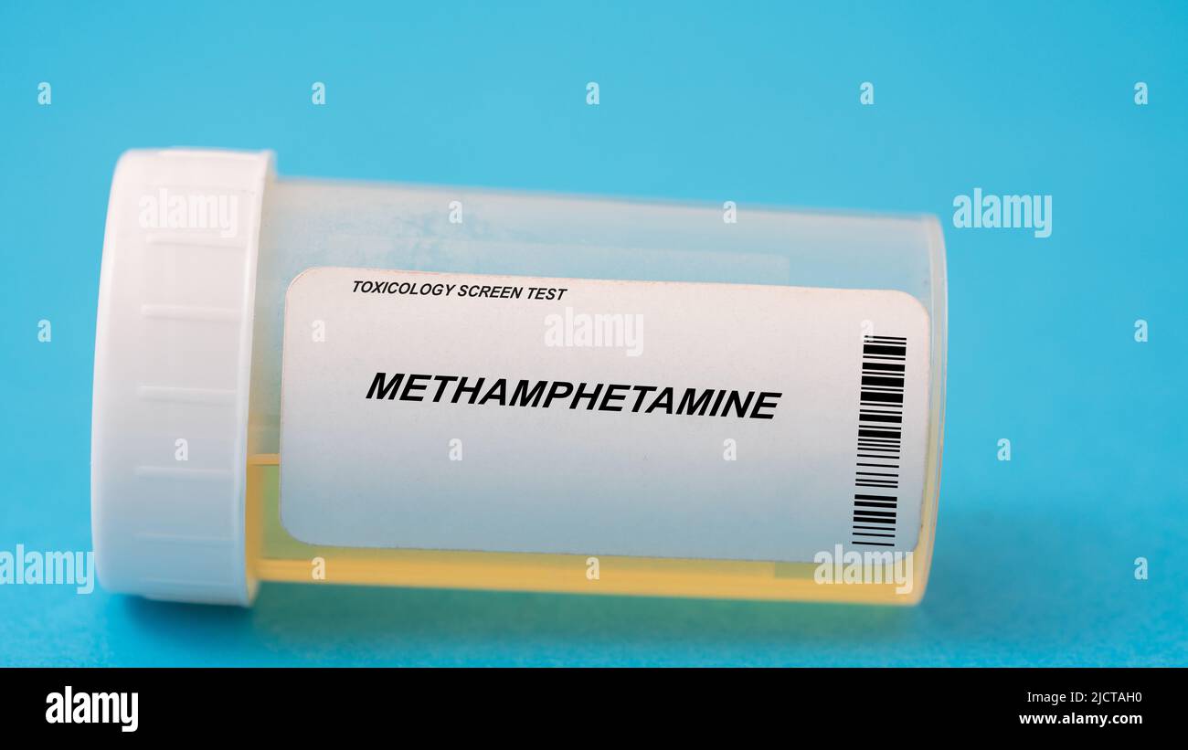 Methamphetamine. Methamphetamine toxicology screen urine tests for ...