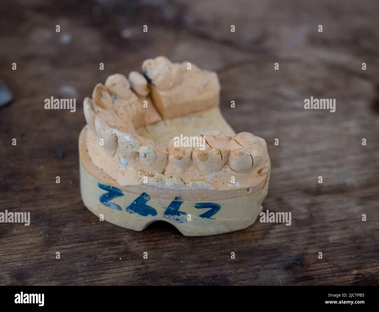 Teeth mold hi-res stock photography and images - Alamy