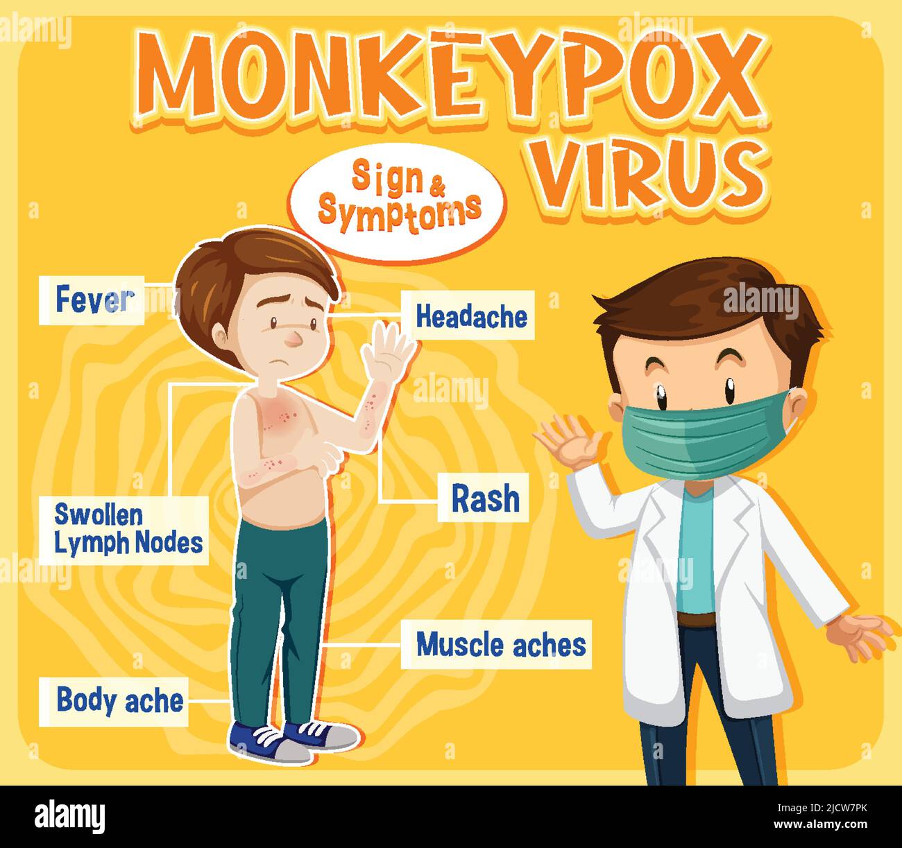 Monkeypox virus sign and symptoms infographic illustration Stock Vector ...