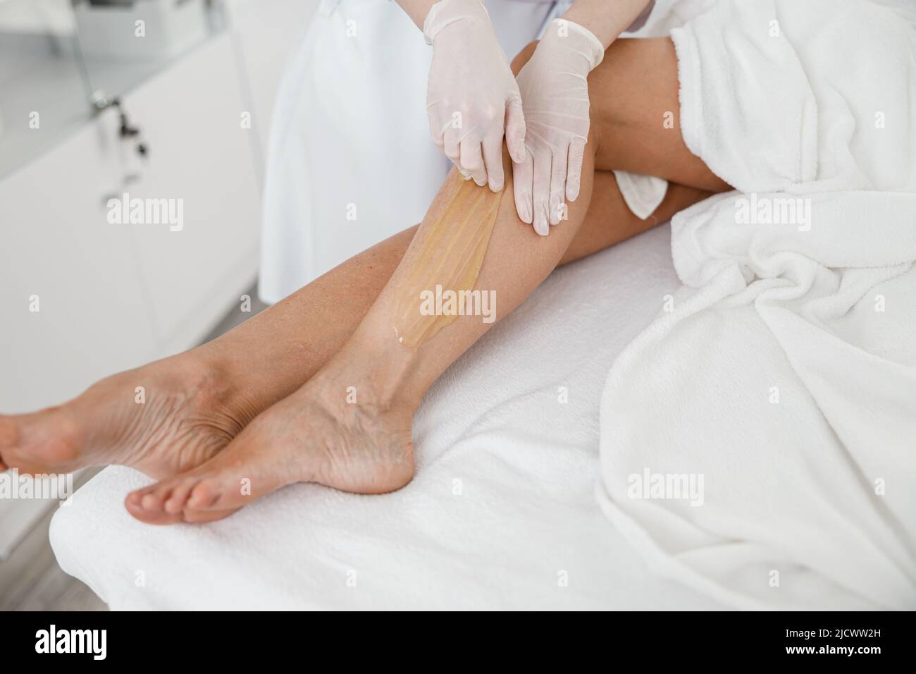 Unwanted dermatologist hi-res stock photography and images - Alamy