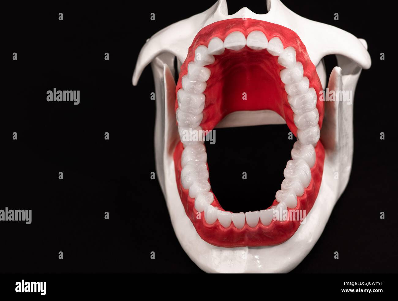 Human jaw with teeth and gums anatomy model isolated on black ...