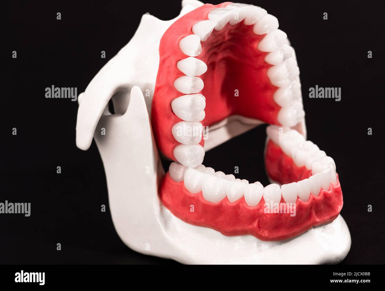 Human jaw with teeth and gums anatomy model isolated on black ...