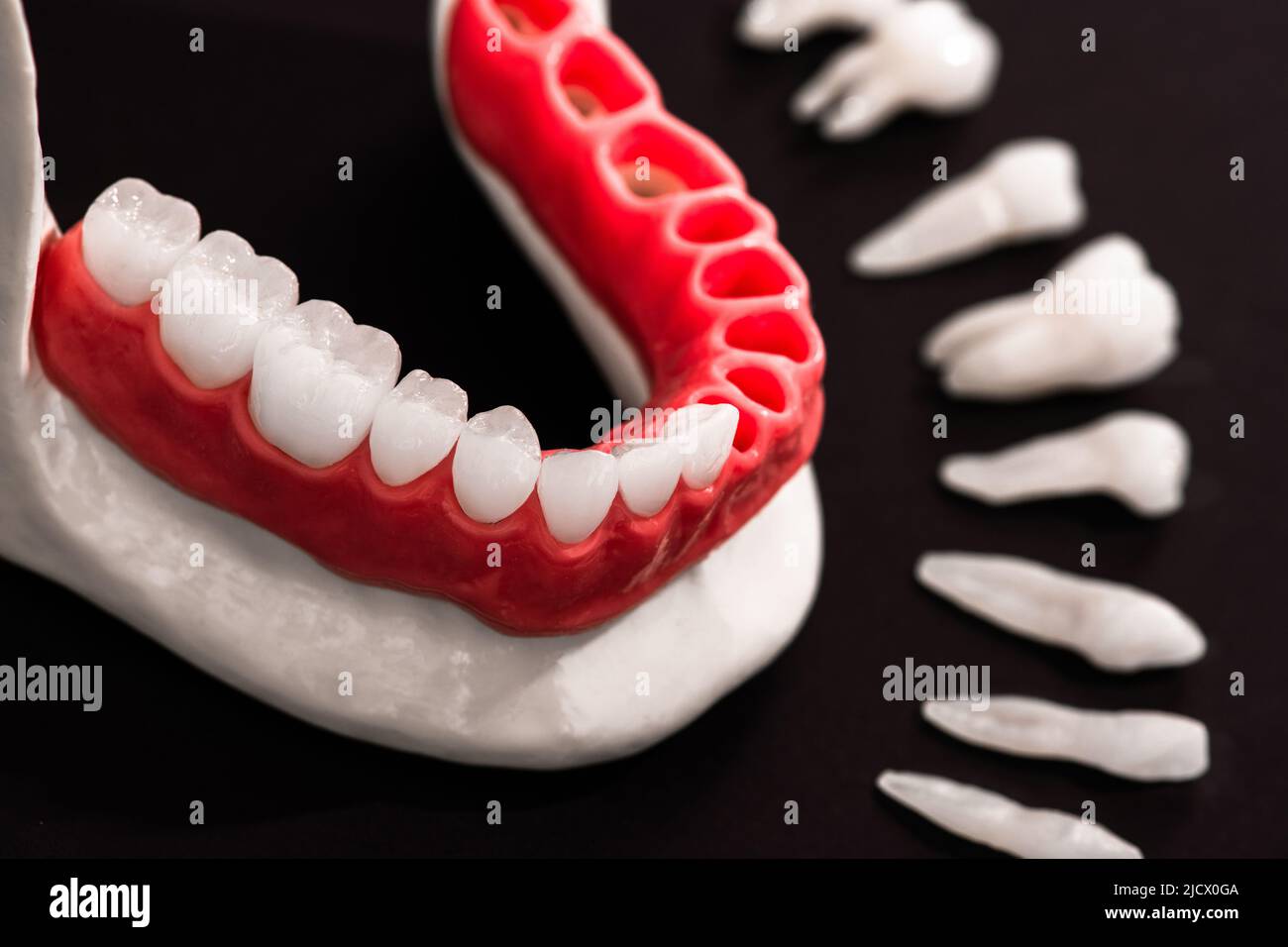 Teeth implant and crown installation process parts isolated on a black ...
