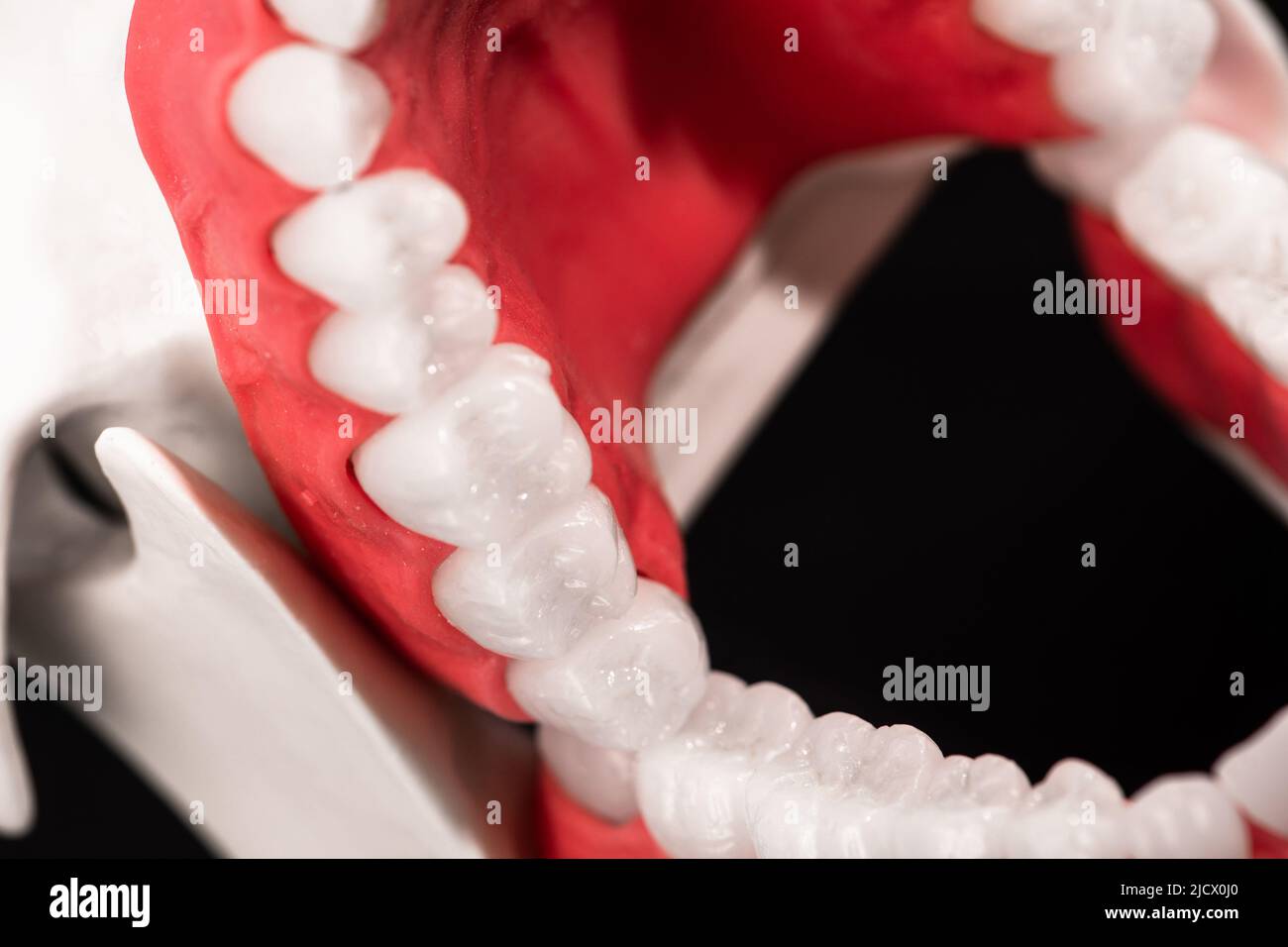 Human jaw with teeth and gums anatomy model isolated on black ...