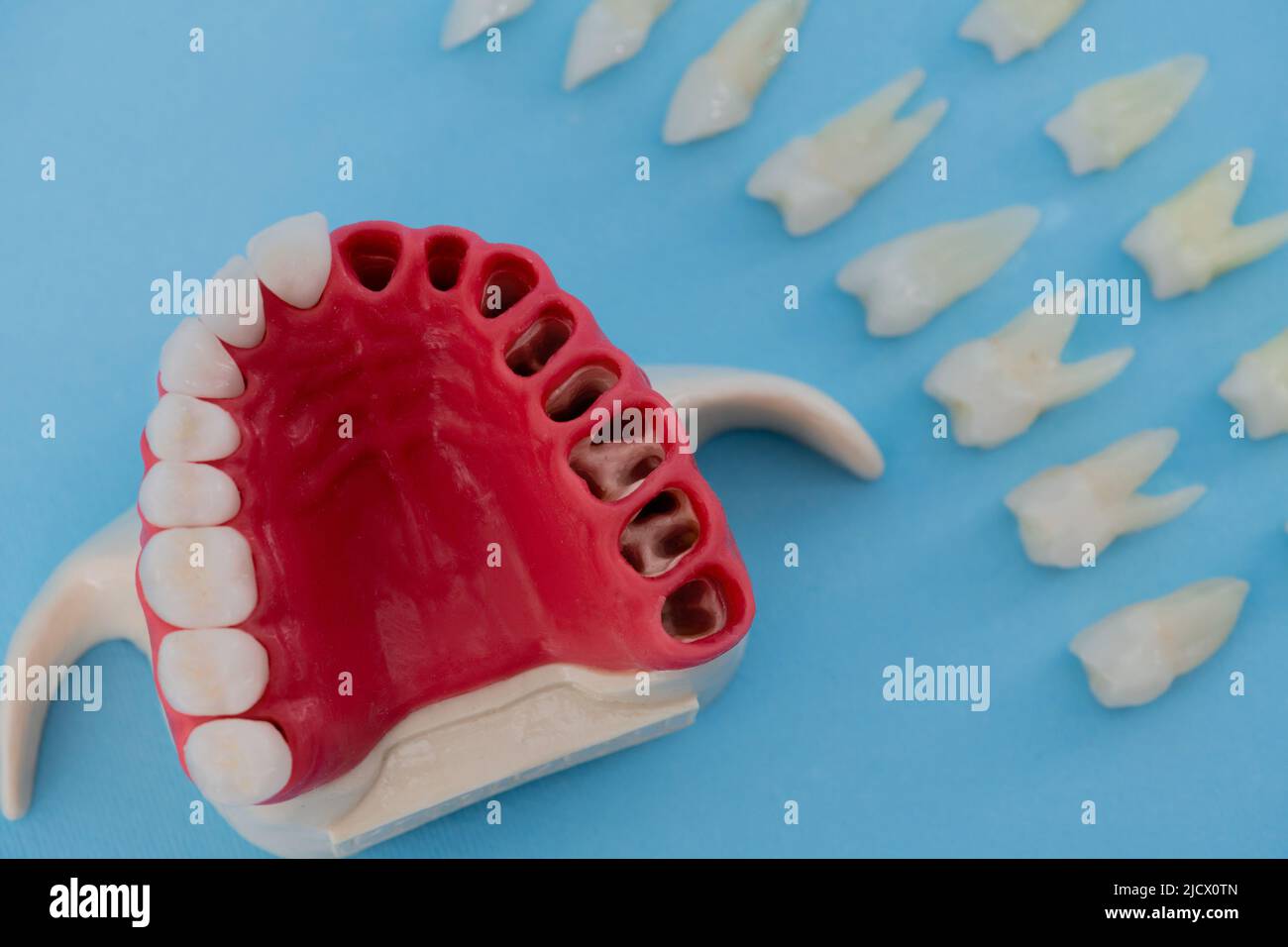 Teeth implant and crown installation process parts isolated on a blue ...