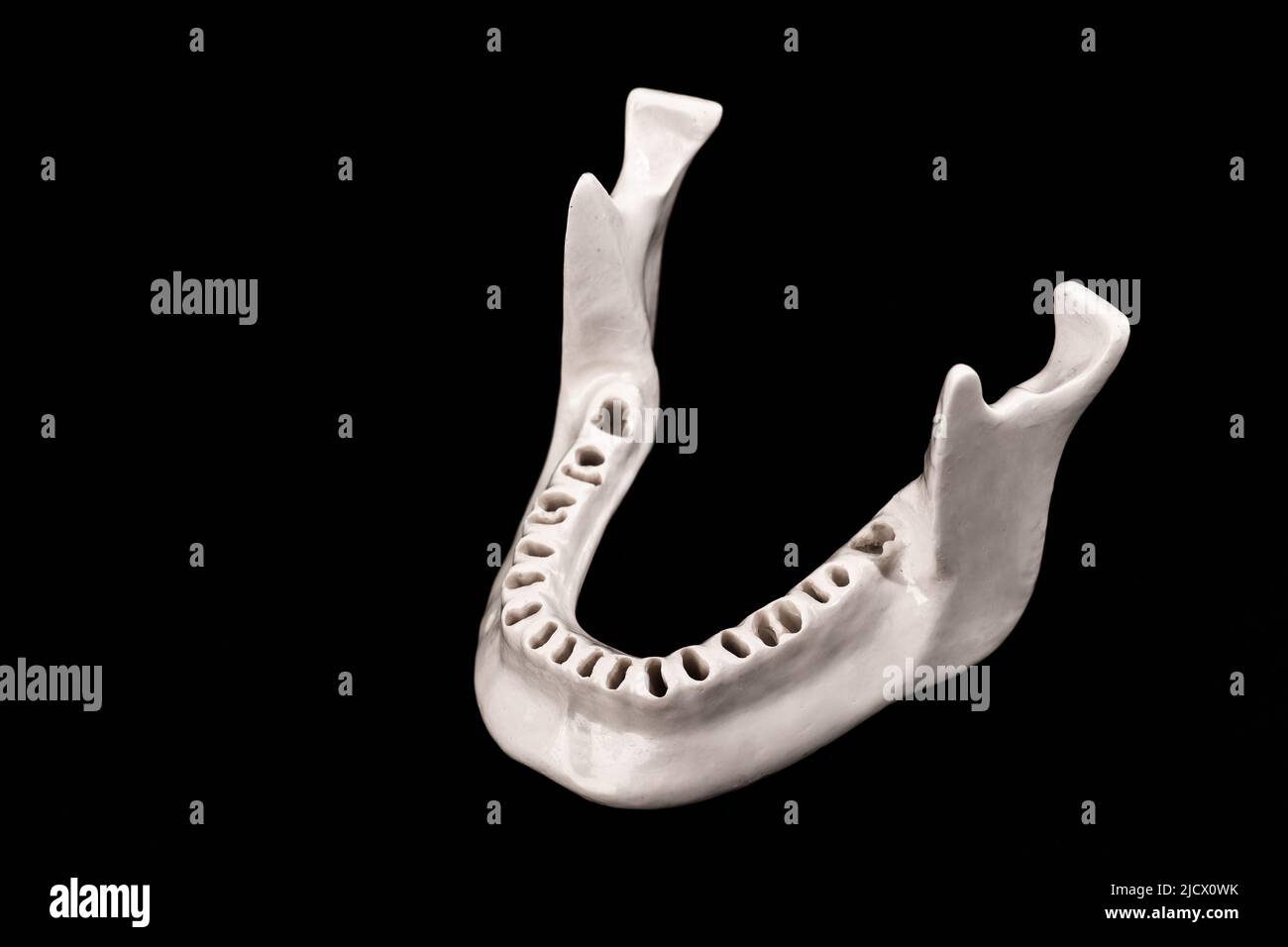 Upper human jaw without teeth model medical implant isolated on black ...