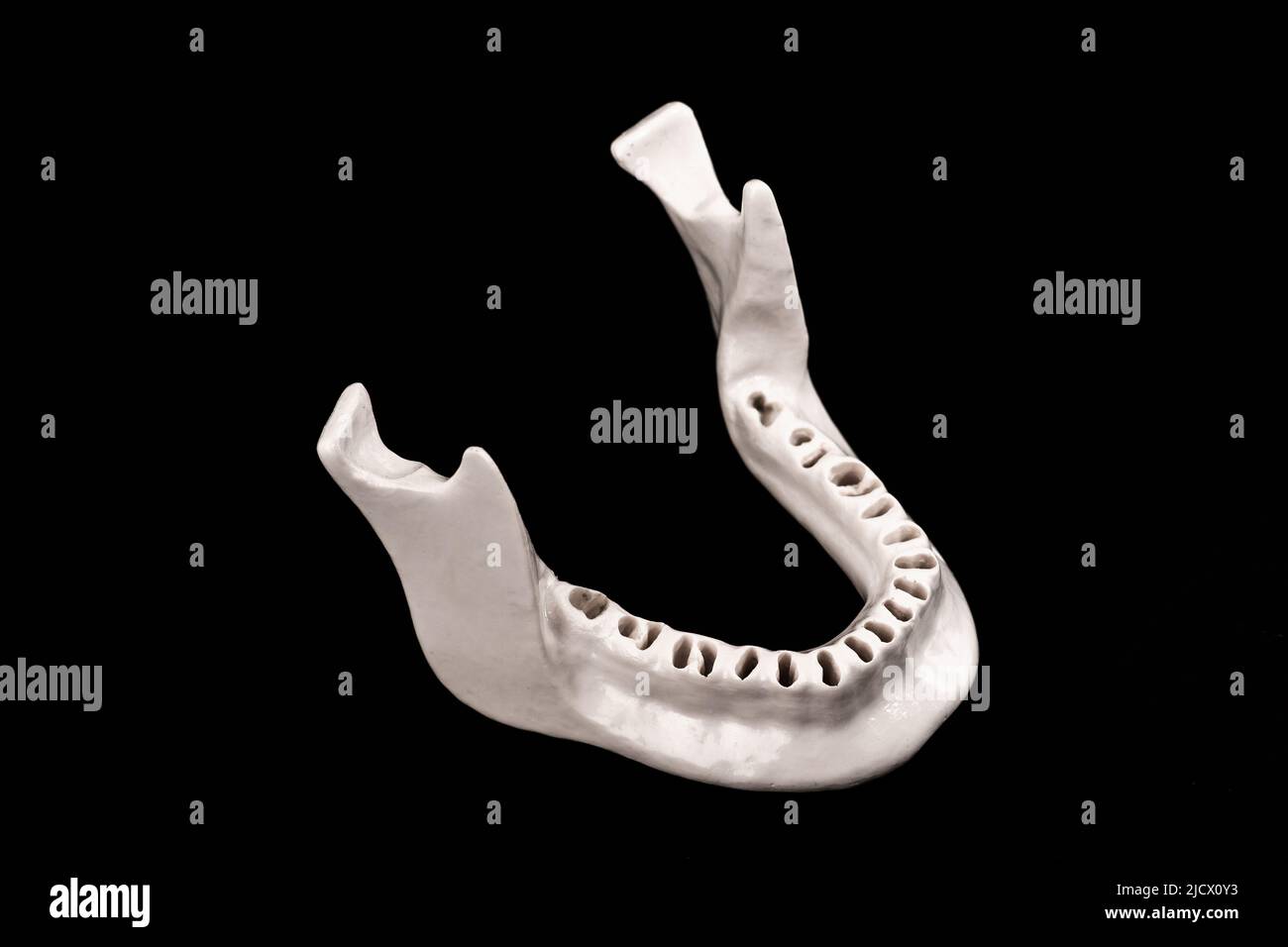 Upper human jaw without teeth model medical implant isolated on black ...