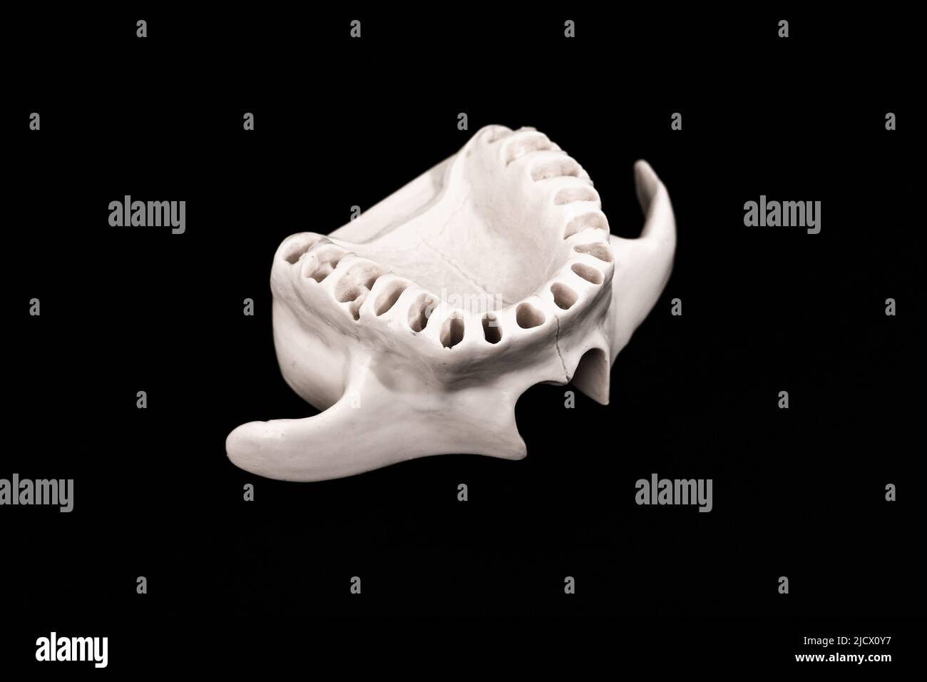 Upper human jaw without teeth model medical implant isolated on black ...