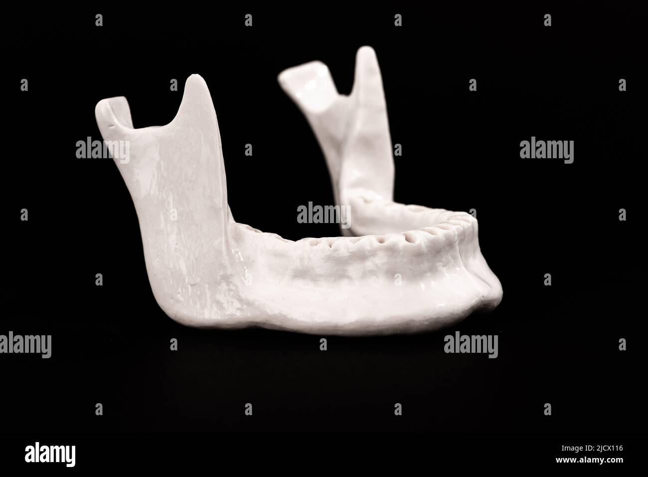 Upper human jaw without teeth model medical implant isolated on black ...