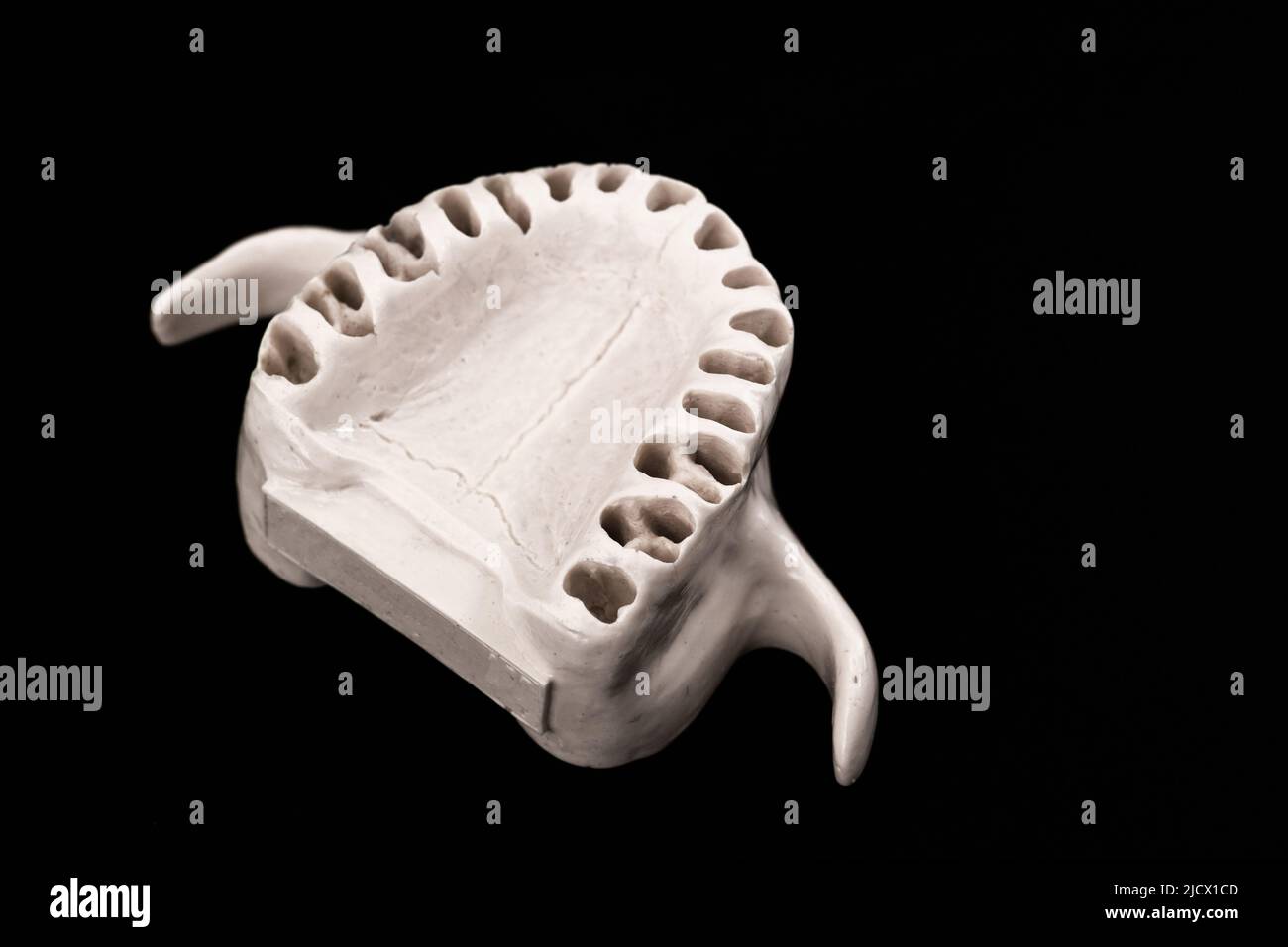 Upper human jaw without teeth model medical implant isolated on black ...