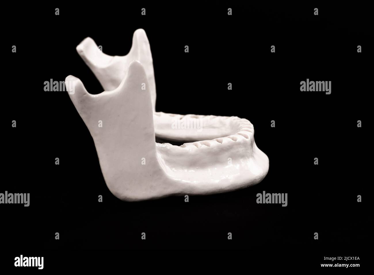 Upper human jaw without teeth model medical implant isolated on black ...