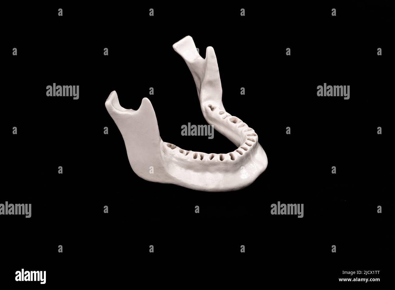 Upper human jaw without teeth model medical implant isolated on black ...