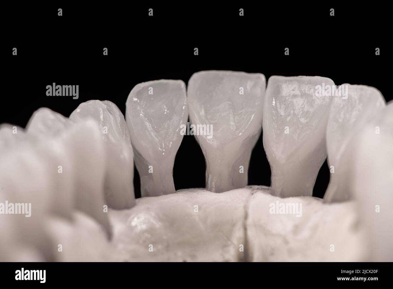 Lower human jaw with teeth anatomy model isolated on black background ...