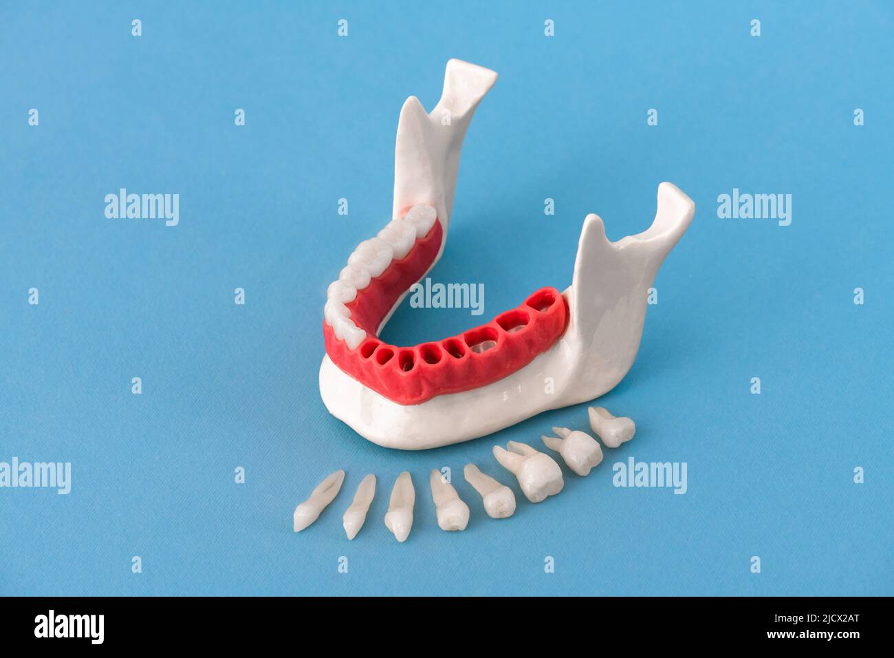 Teeth implant and crown installation process parts isolated on a blue ...