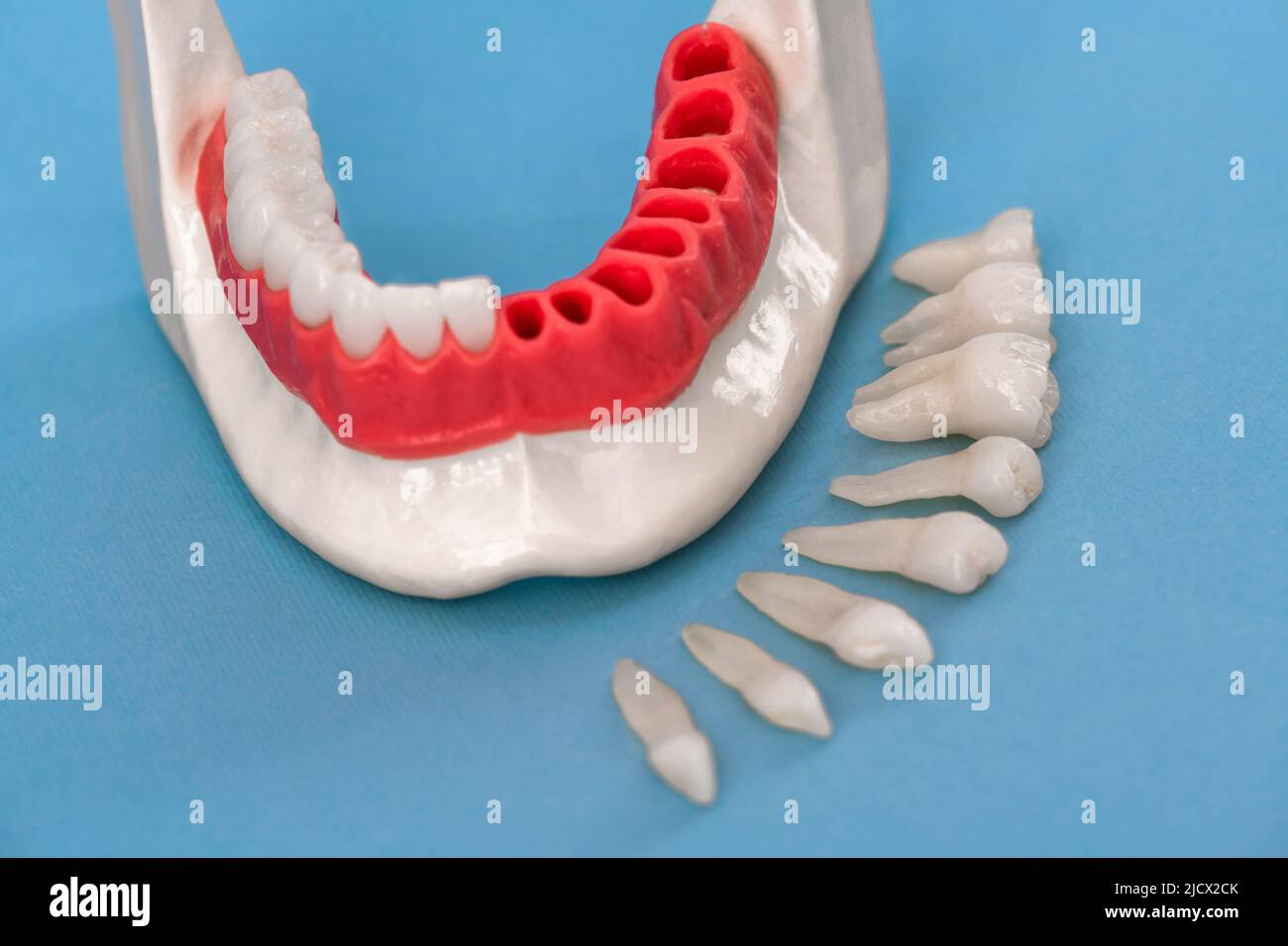 Teeth implant and crown installation process parts isolated on a blue ...
