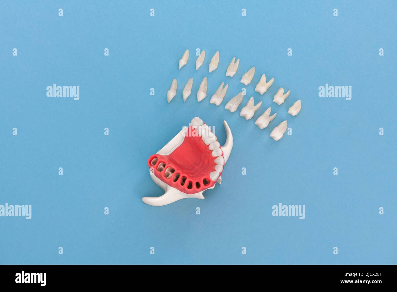 Teeth implant and crown installation process parts isolated on a blue ...