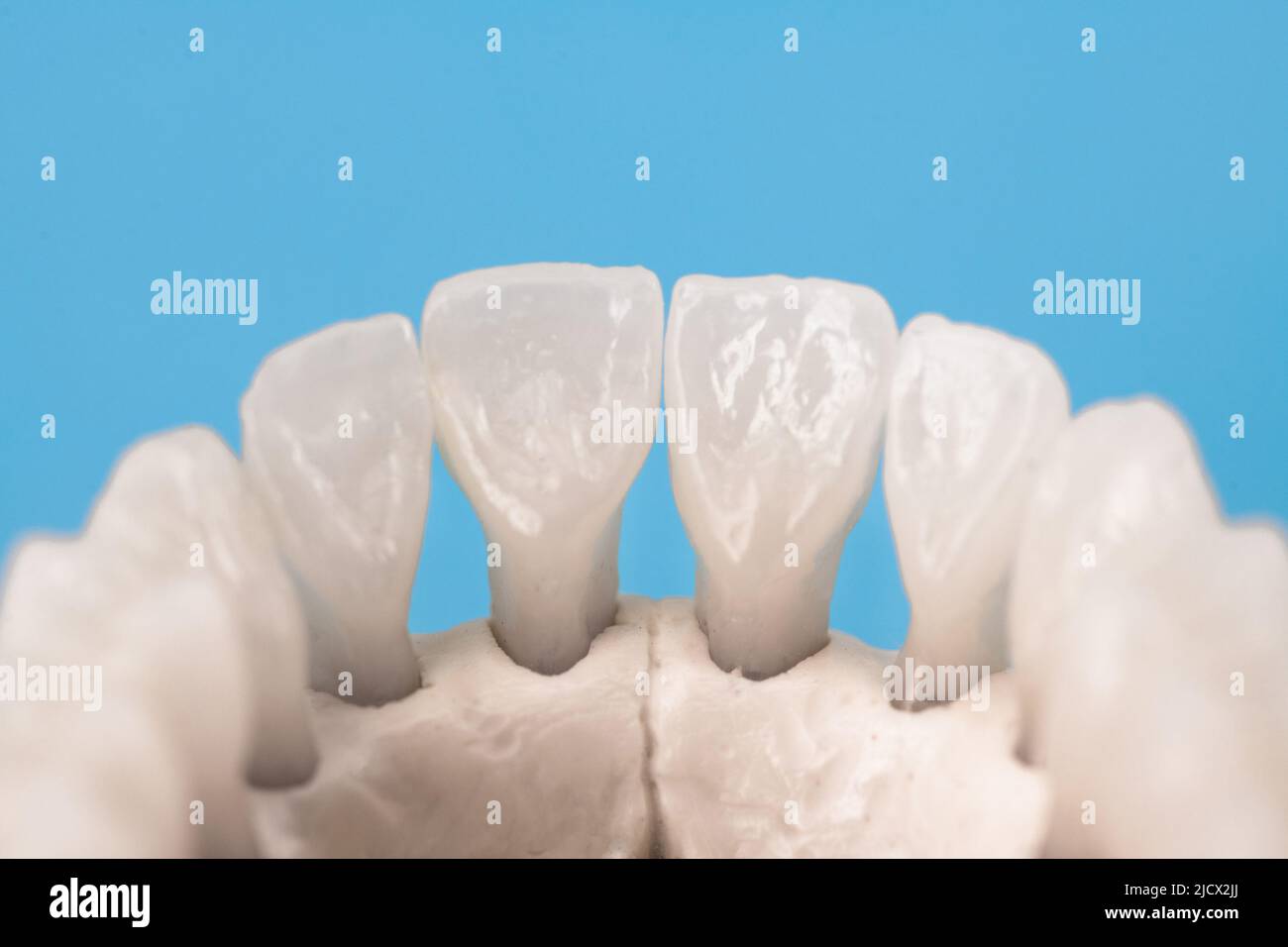 Upper human jaw with teeth anatomy model isolated on blue background ...