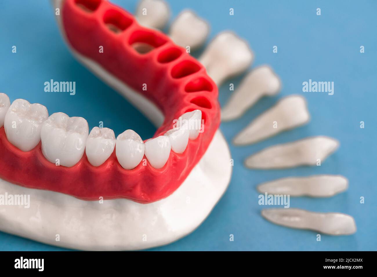 Teeth implant and crown installation process parts isolated on a blue ...