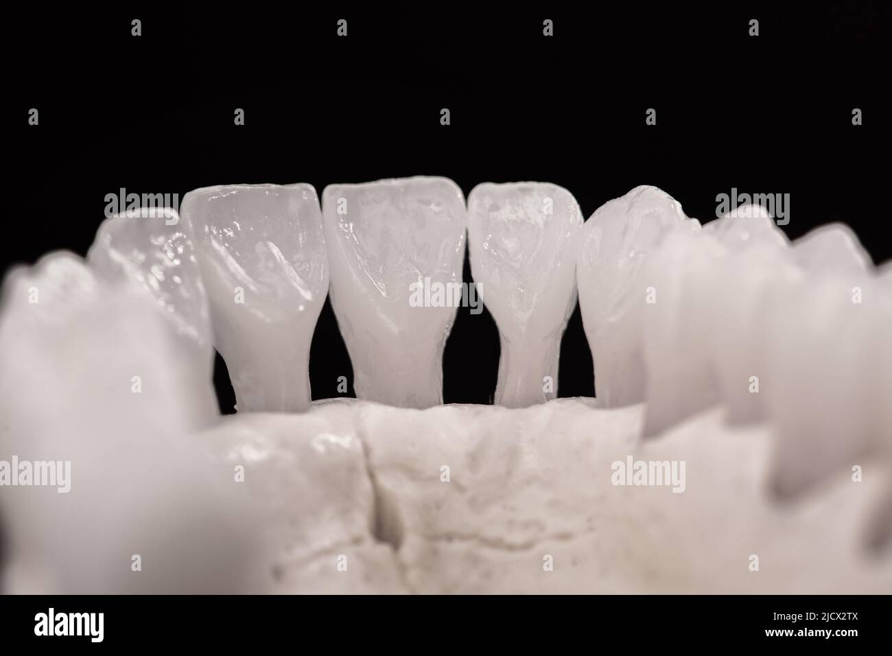 Lower human jaw with teeth anatomy model isolated on black background ...