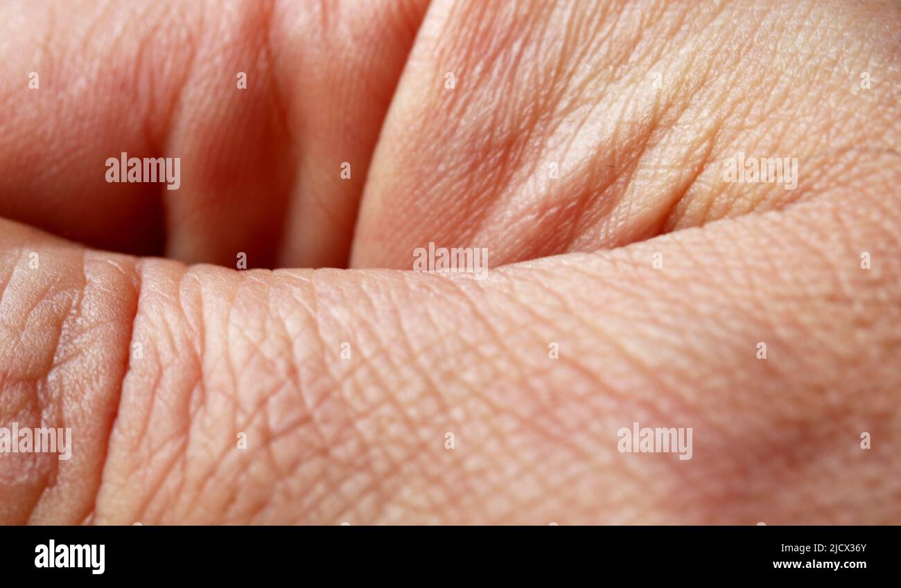 Atrophy skin hi-res stock photography and images - Alamy