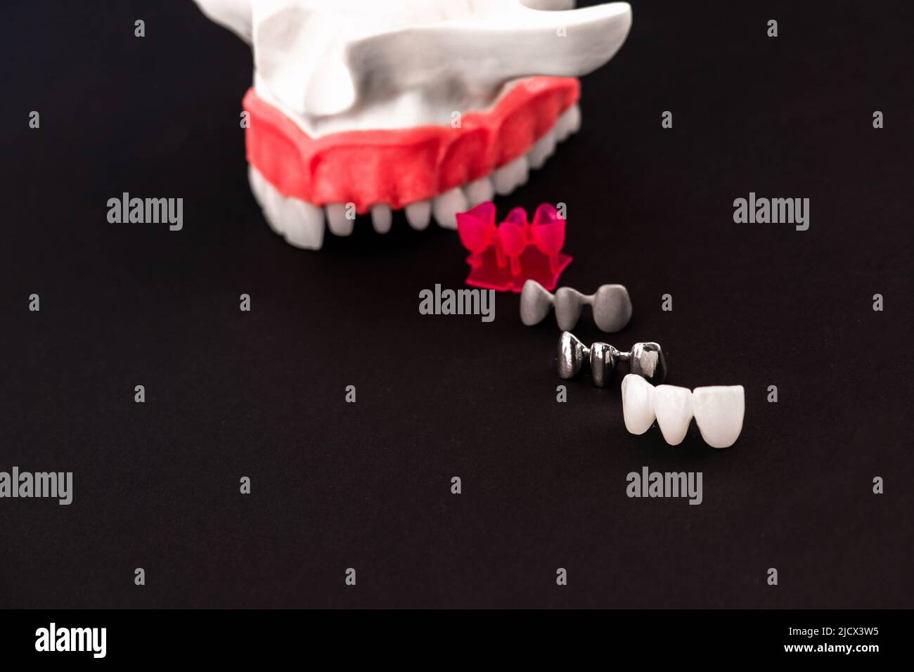 Teeth implant and crown installation process parts isolated on a blue ...