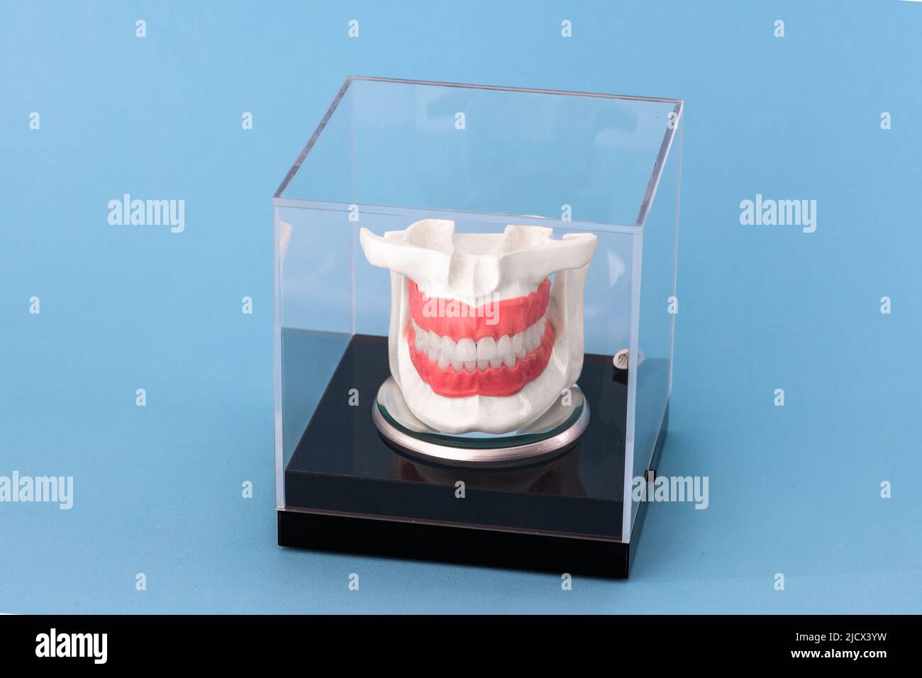 Human jaw with teeth implants anatomy model isolated on blue background ...