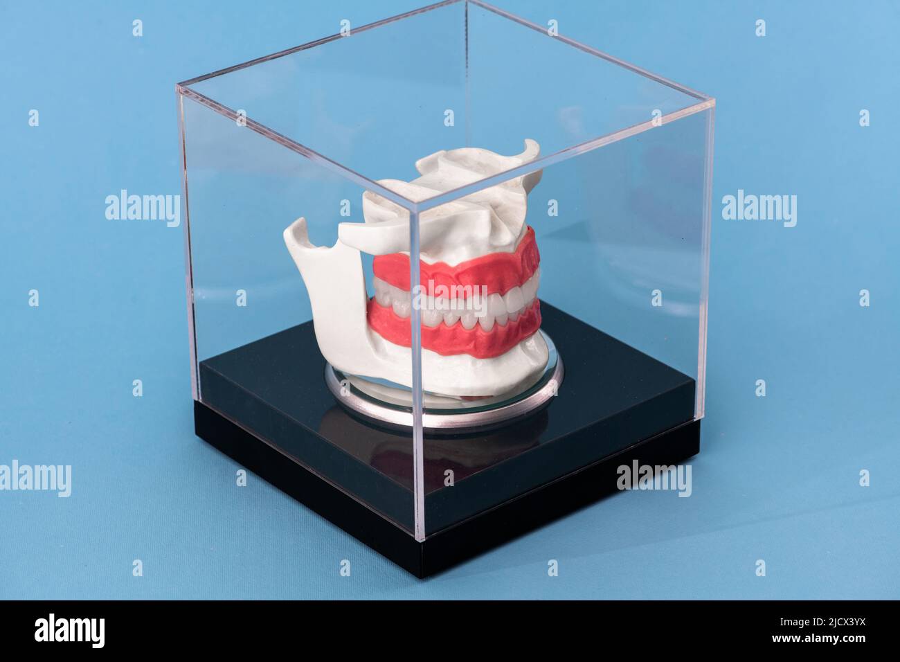 Human jaw with teeth implants anatomy model isolated on blue background ...