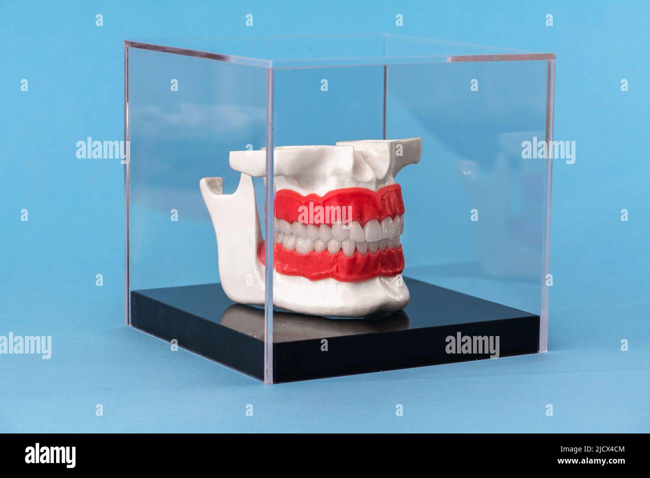 Human jaw with teeth implants anatomy model isolated on blue background ...