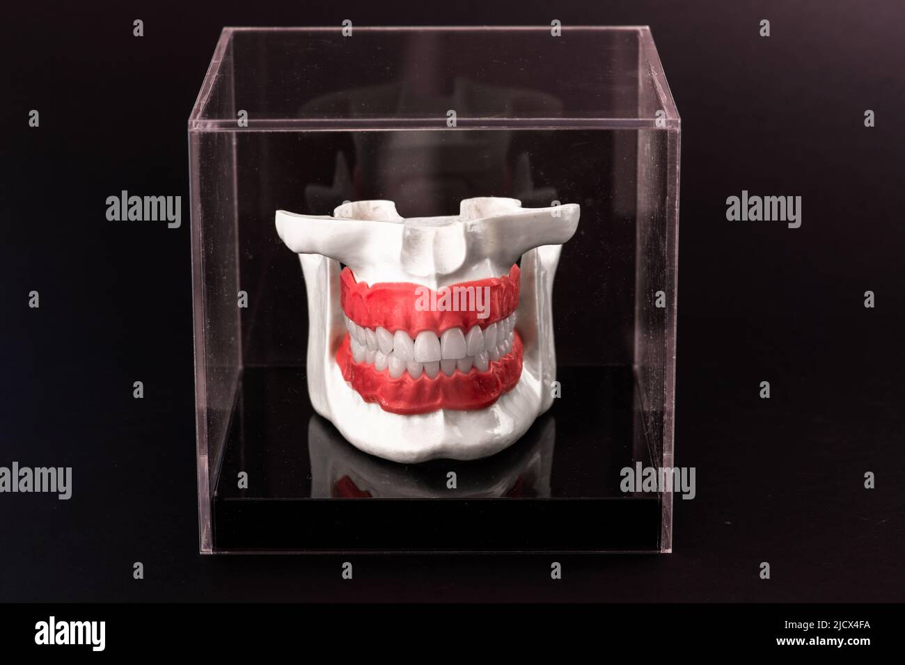 Human jaw with teeth implants anatomy model isolated on black ...