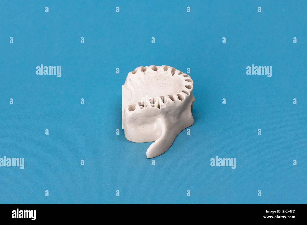 Upper human jaw without teeth model medical implant isolated on blue ...