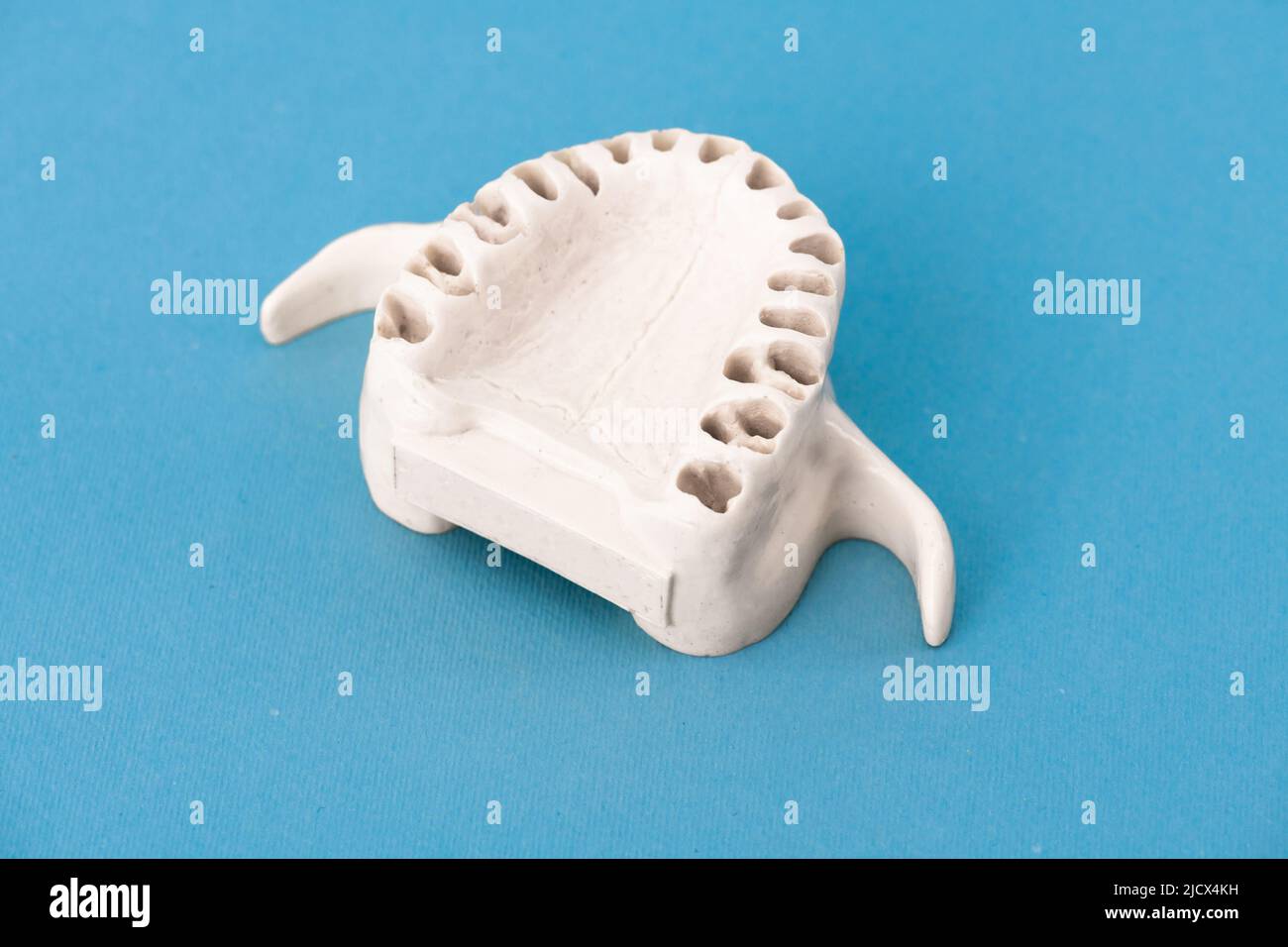 Upper human jaw without teeth model medical implant isolated on blue ...